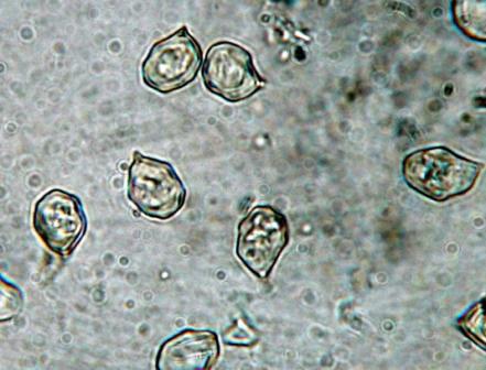 spore Entoloma (nolanea) , Natura Mediterraneo | Forum Naturalistico