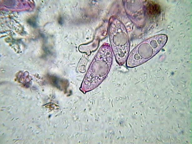 Discina perlata (Fr.: Fr.) Fr. , Natura Mediterraneo | Forum Naturalistico