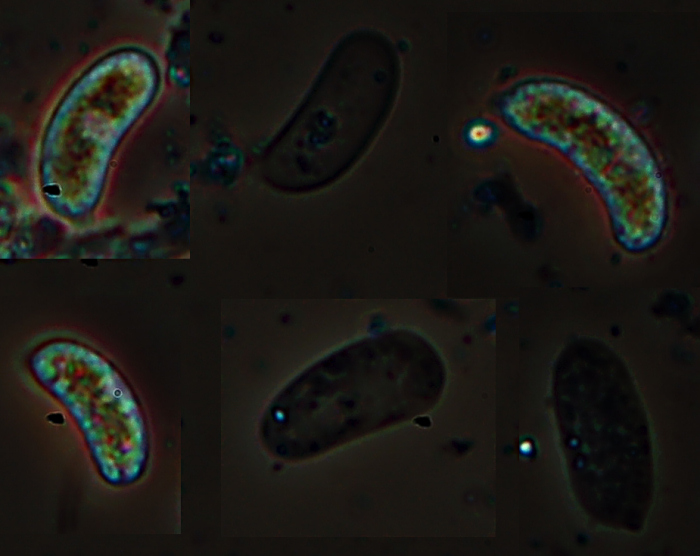 Macchie bianche su nocciolo (Exidiopsis calcea) , Natura Mediterraneo ...