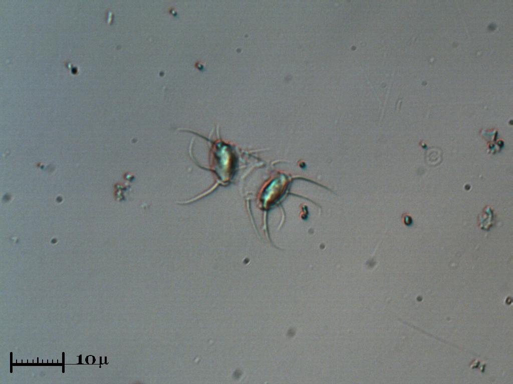 Scenedesmus? , Natura Mediterraneo | Forum Naturalistico