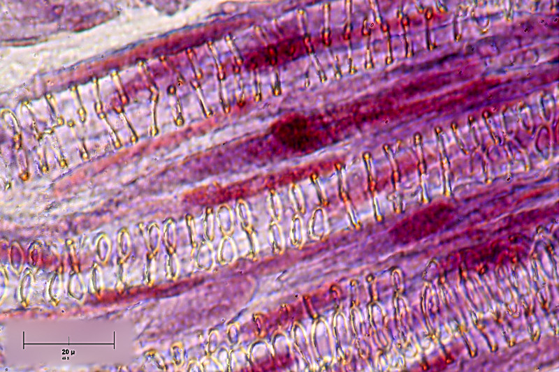 tracheide anulare ? , Natura Mediterraneo | Forum Naturalistico