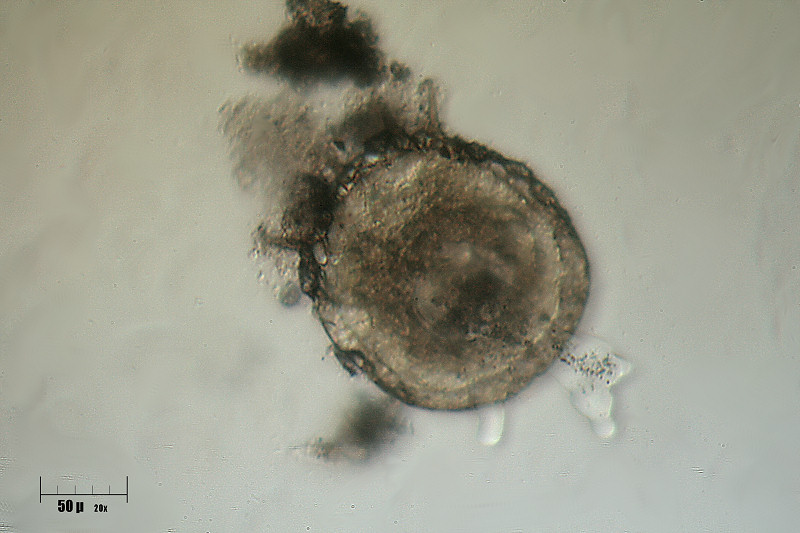 Tecameba - Centropyxis sp. ?? , Natura Mediterraneo | Forum Naturalistico