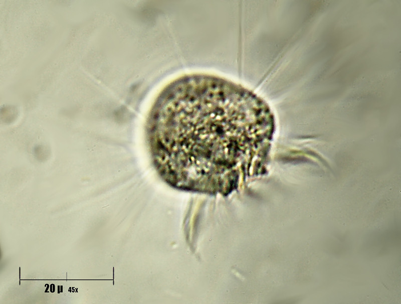 Halteria sp. , Natura Mediterraneo | Forum Naturalistico