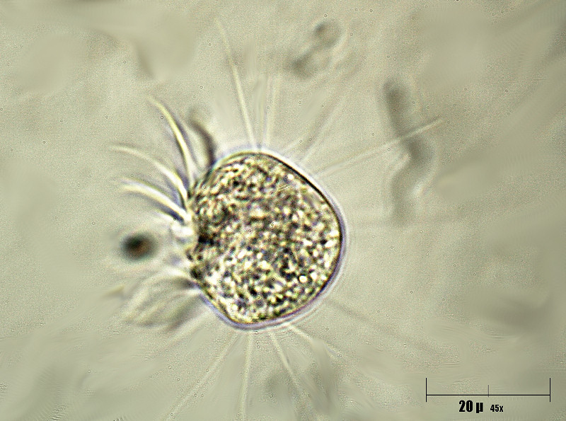 Halteria sp. , Natura Mediterraneo | Forum Naturalistico