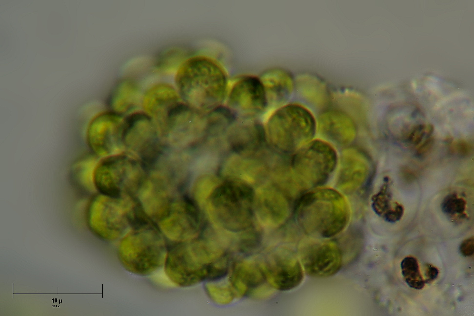 Eudorina sp. , Natura Mediterraneo | Forum Naturalistico