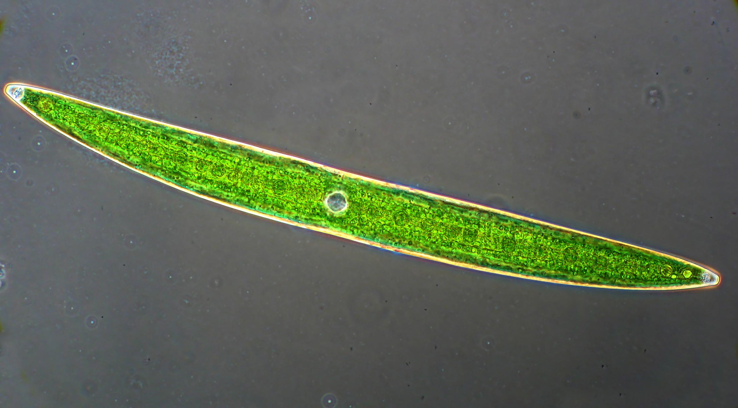 Closterium acerosum , Natura Mediterraneo | Forum Naturalistico