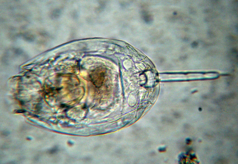 Lecane gruppo lunaris , Natura Mediterraneo | Forum Naturalistico