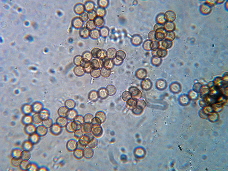 Stemonitis sp. , Natura Mediterraneo | Forum Naturalistico