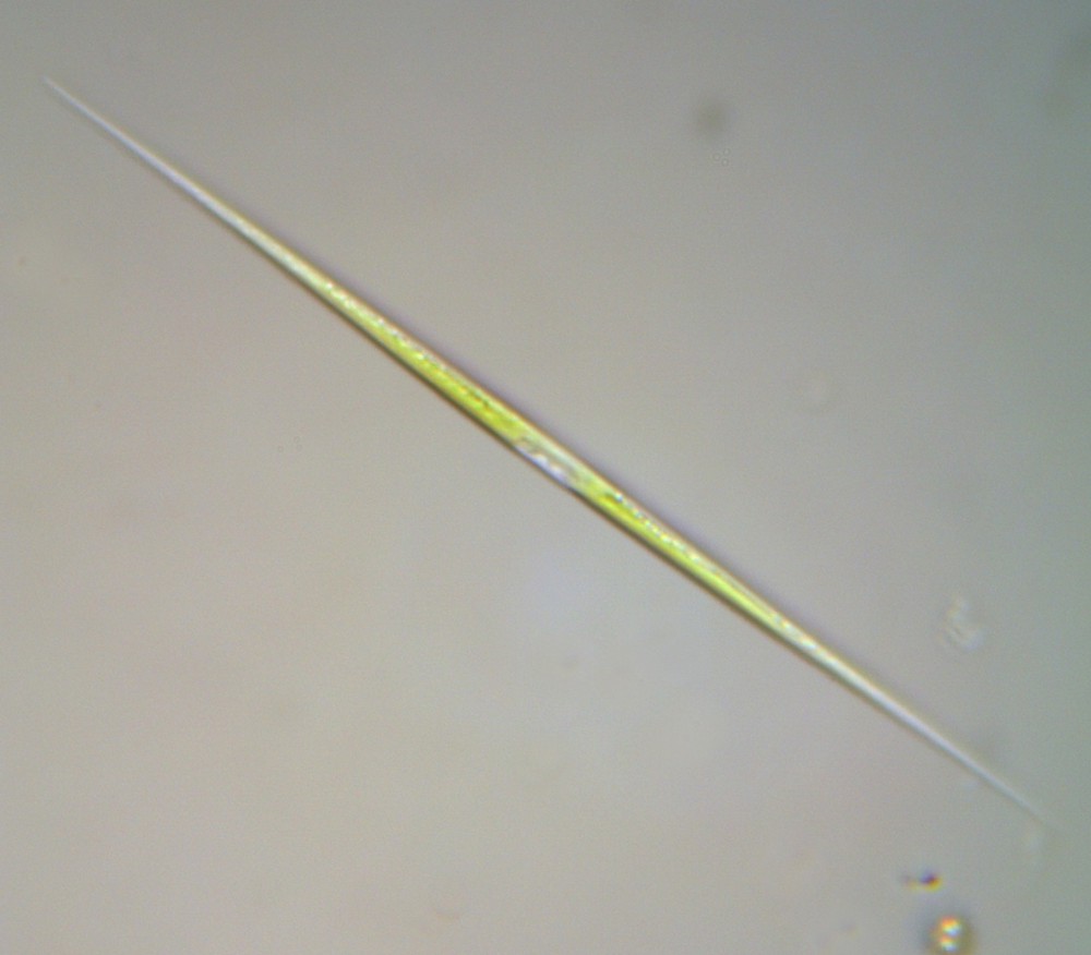 dactylococcopsis? , Natura Mediterraneo | Forum Naturalistico