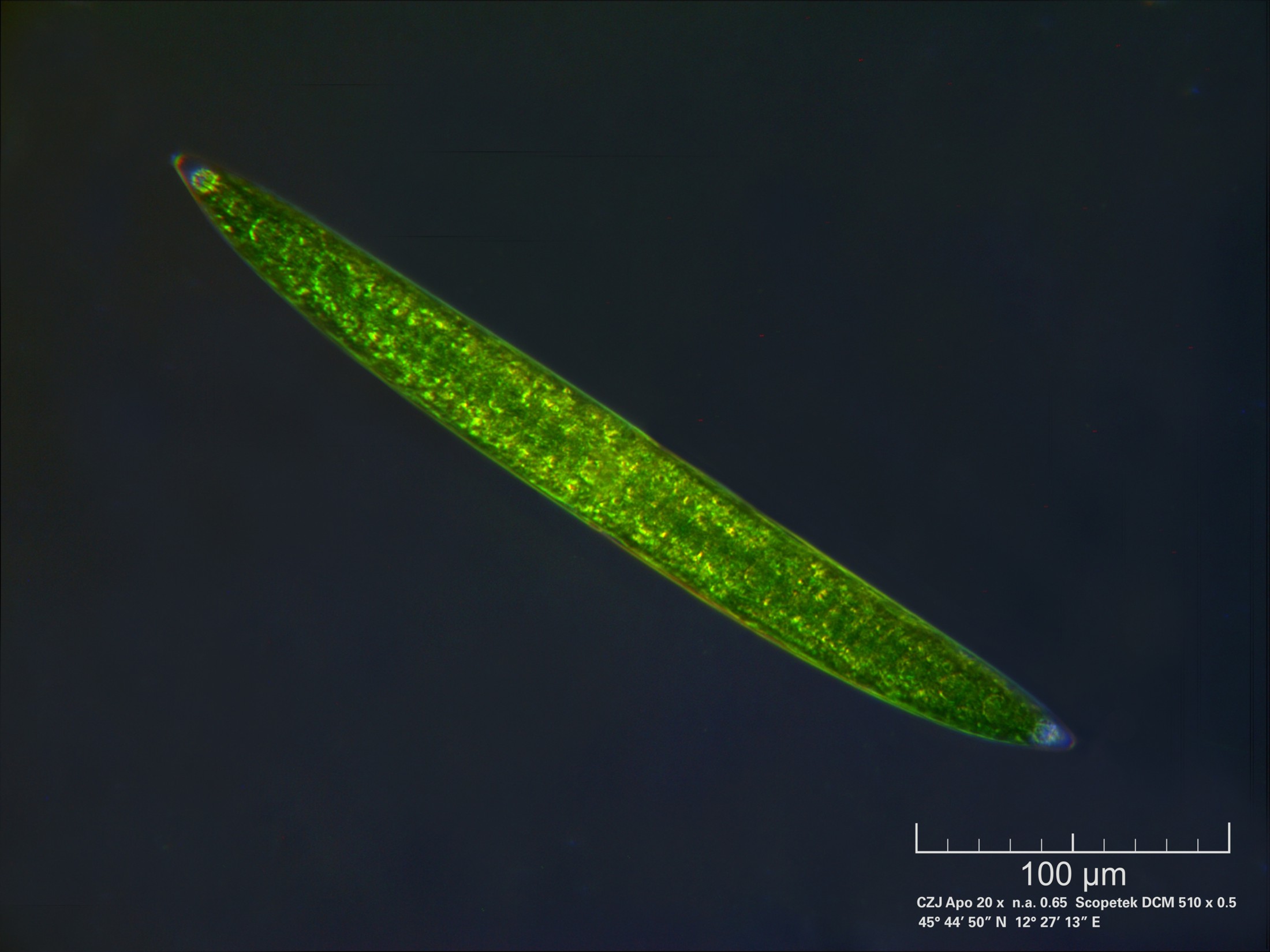 Closterium , Natura Mediterraneo | Forum Naturalistico