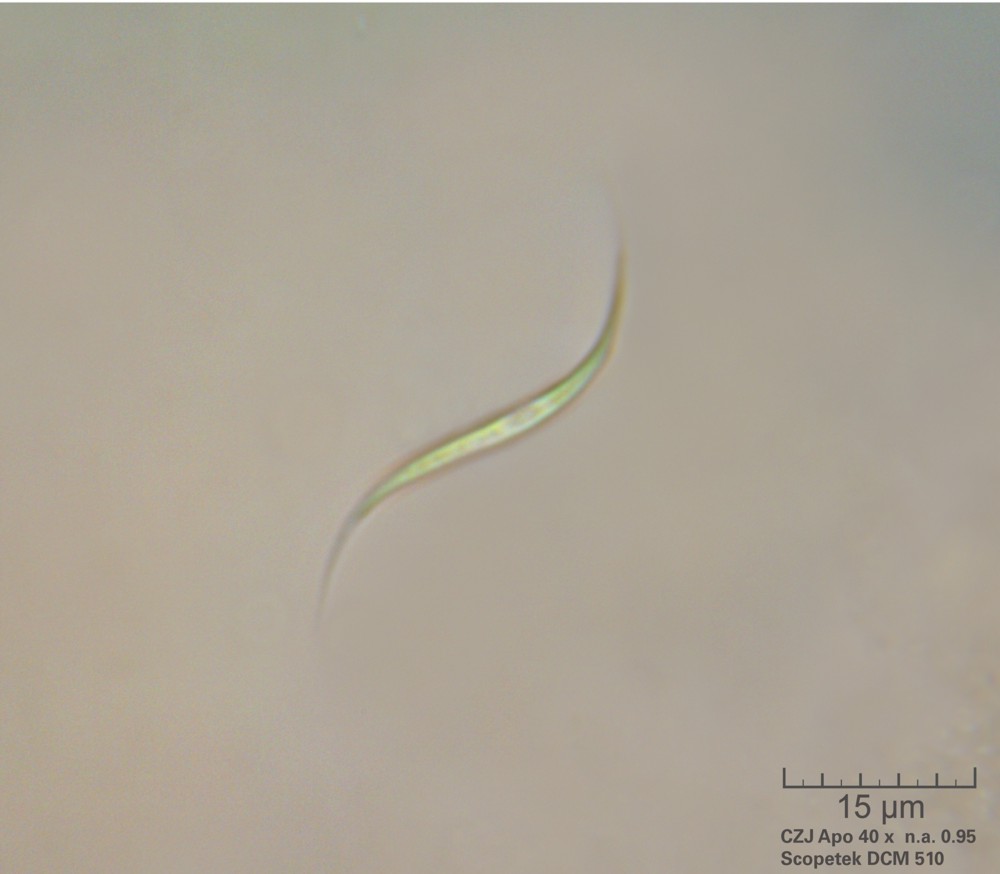 dactylococcopsis? , Natura Mediterraneo | Forum Naturalistico