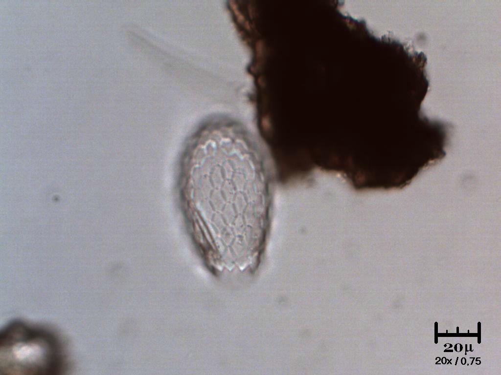 Euglypha sp. , Natura Mediterraneo | Forum Naturalistico