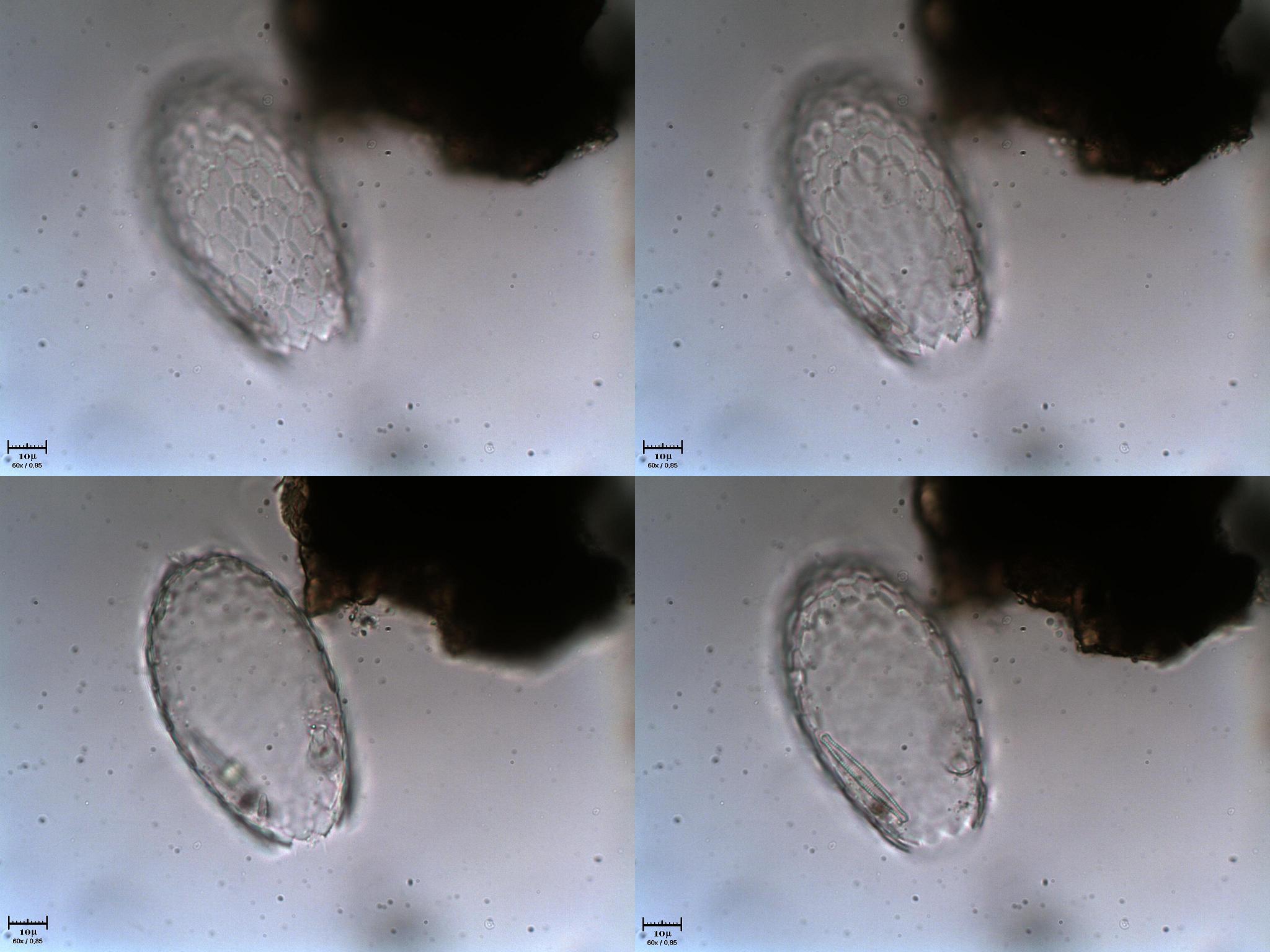 Euglypha sp. , Natura Mediterraneo | Forum Naturalistico