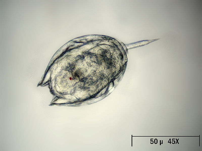 Lecane hamata ? , Natura Mediterraneo | Forum Naturalistico