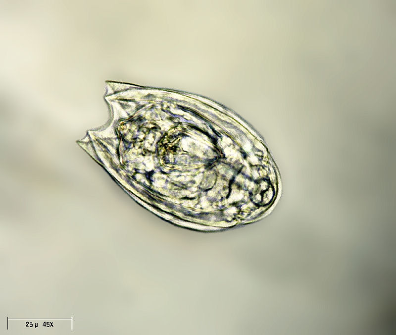 Lecane hamata ? , Natura Mediterraneo | Forum Naturalistico