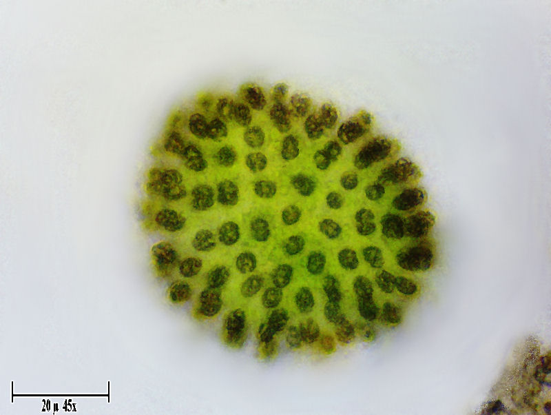 Microcystis sp. , Natura Mediterraneo | Forum Naturalistico