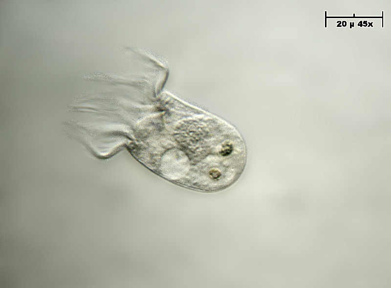 Strombidium sp. ? , Natura Mediterraneo | Forum Naturalistico