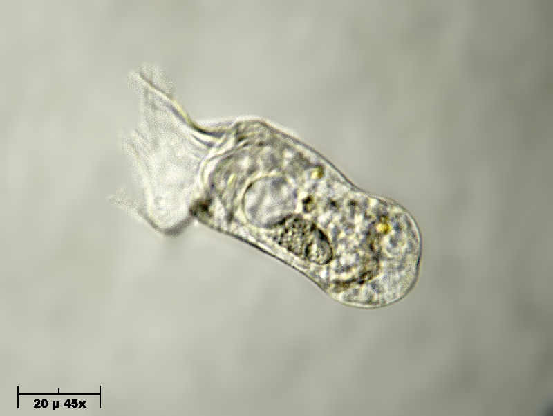 Strombidium sp. ? , Natura Mediterraneo | Forum Naturalistico