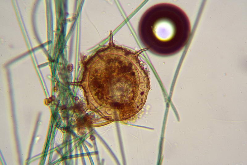 centropyxis , Natura Mediterraneo | Forum Naturalistico