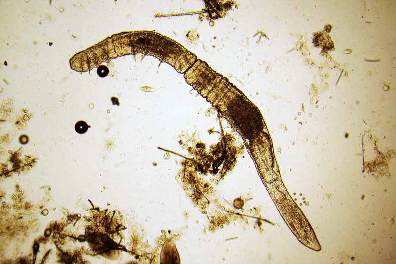 Chaetogaster sp. , Natura Mediterraneo | Forum Naturalistico