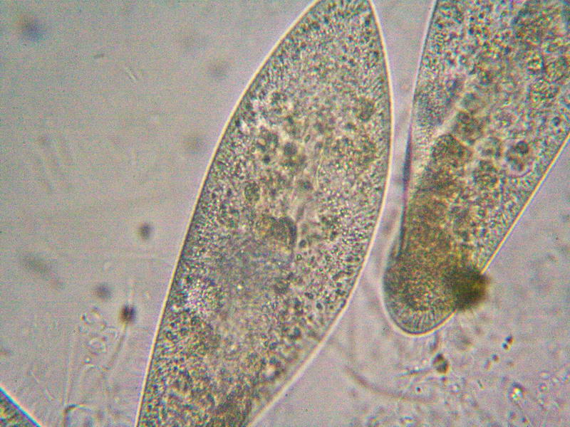 Paramecium sp. (400x - 200x) , Natura Mediterraneo | Forum Naturalistico