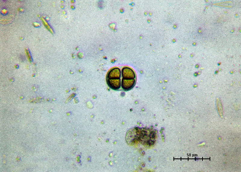 Chroococcus sp. , Natura Mediterraneo | Forum Naturalistico