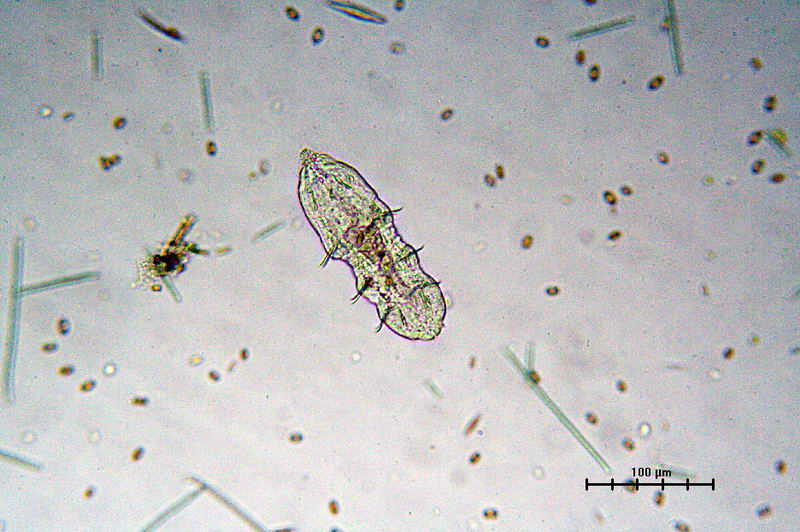 Chaetogaster sp. , Natura Mediterraneo | Forum Naturalistico