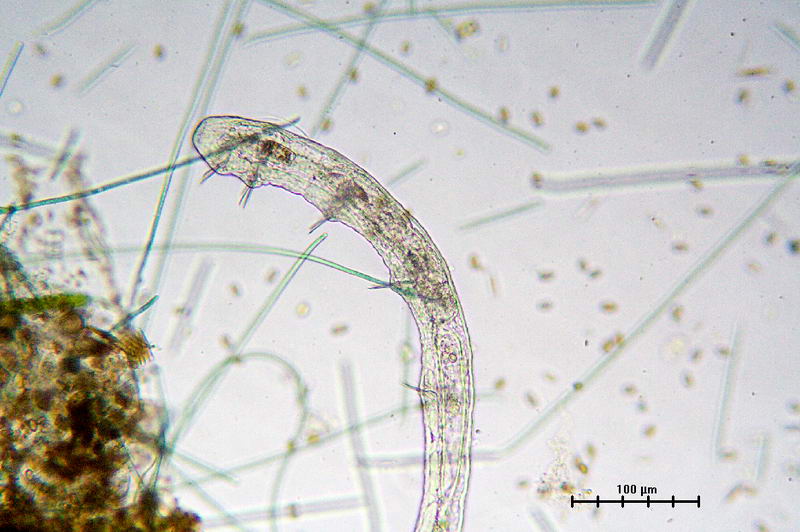 Chaetogaster sp. , Natura Mediterraneo | Forum Naturalistico