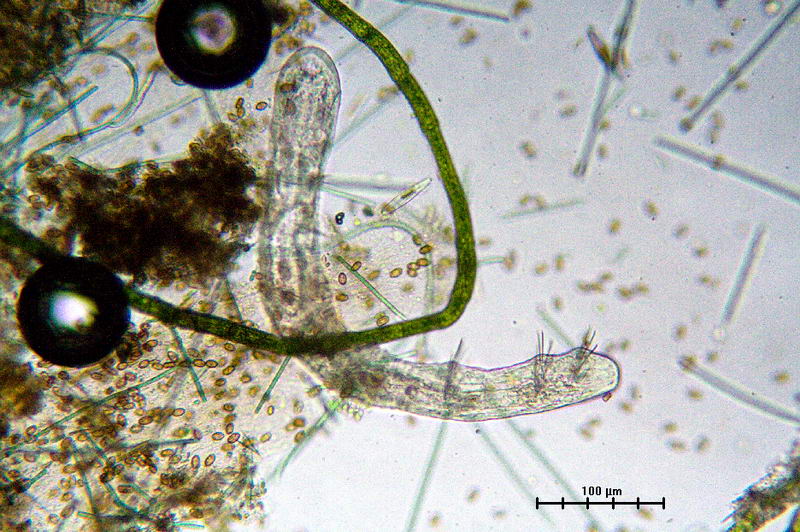 Chaetogaster sp. , Natura Mediterraneo | Forum Naturalistico