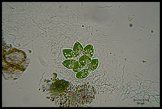 Coelastrum sp??? , Natura Mediterraneo | Forum Naturalistico