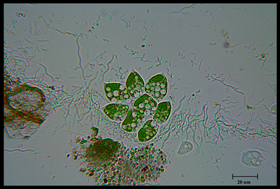 Coelastrum sp??? , Natura Mediterraneo | Forum Naturalistico