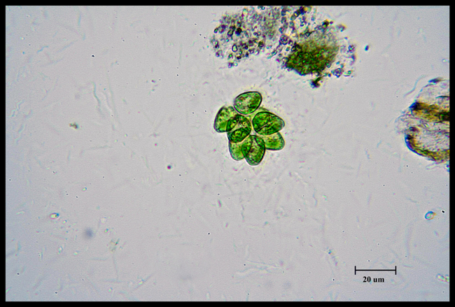 Coelastrum sp??? , Natura Mediterraneo | Forum Naturalistico