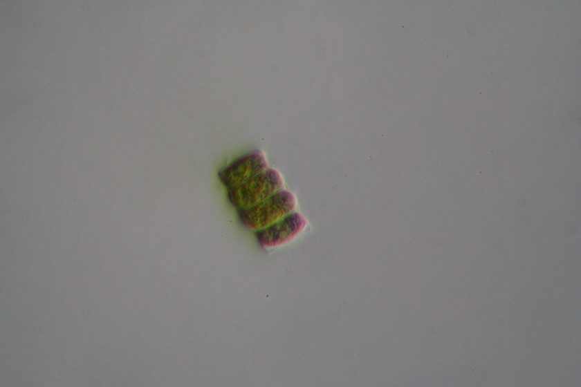 Scenedesmus , Natura Mediterraneo | Forum Naturalistico