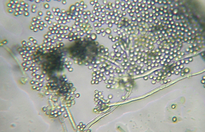 Muffa del pane , Natura Mediterraneo | Forum Naturalistico