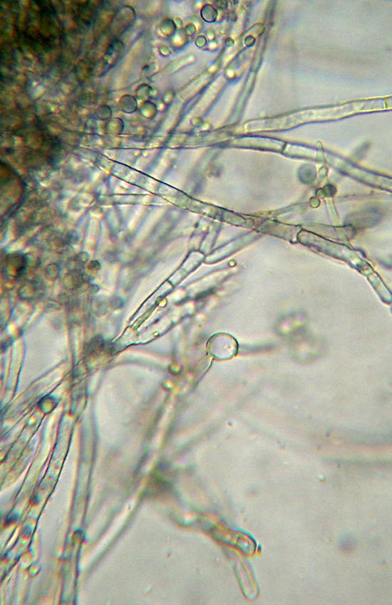 Muffa del pane , Natura Mediterraneo | Forum Naturalistico