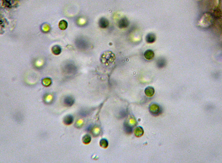 Forse Mucidosphaerium pulchellum [ Dictyosphaerium sp. ] , Natura ...