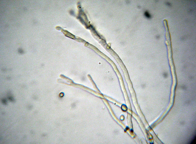 Muffa dell'arancia , Natura Mediterraneo | Forum Naturalistico