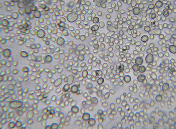 Muffa del passato di pomodoro , Natura Mediterraneo | Forum Naturalistico