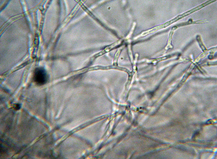 Muffa del passato di pomodoro , Natura Mediterraneo | Forum Naturalistico