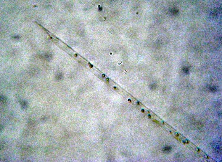 Il ritorno delle diatomee marine , Natura Mediterraneo | Forum ...