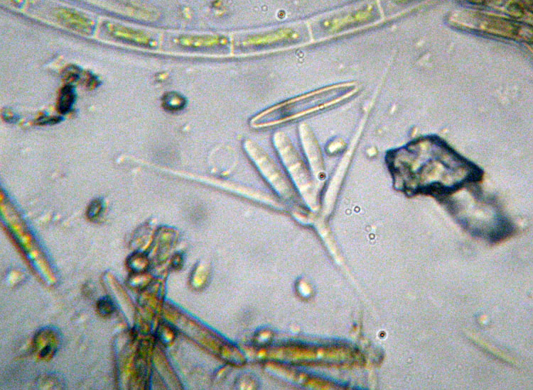 Fungo acquatico: direi Tetracladium setigerum , Natura Mediterraneo ...