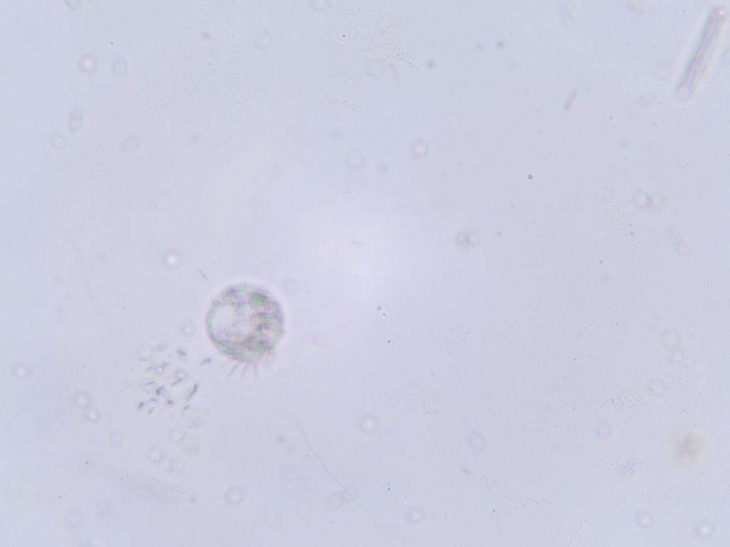 Halteria sp.? , Natura Mediterraneo | Forum Naturalistico