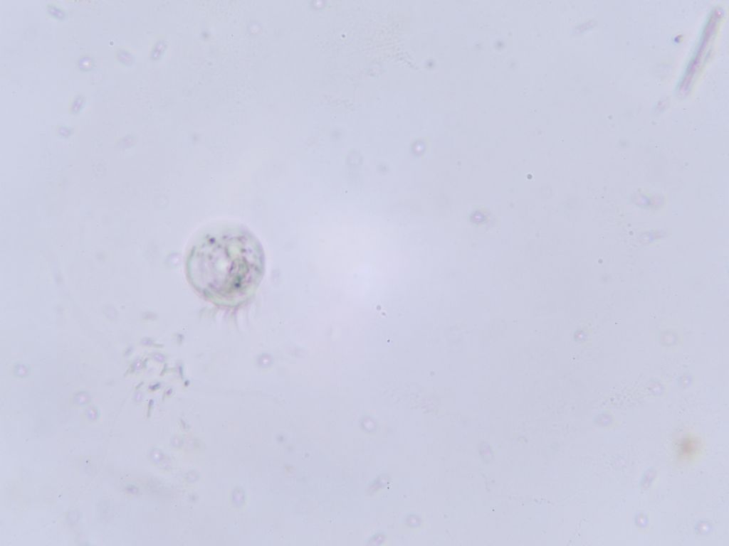 Halteria sp.? , Natura Mediterraneo | Forum Naturalistico