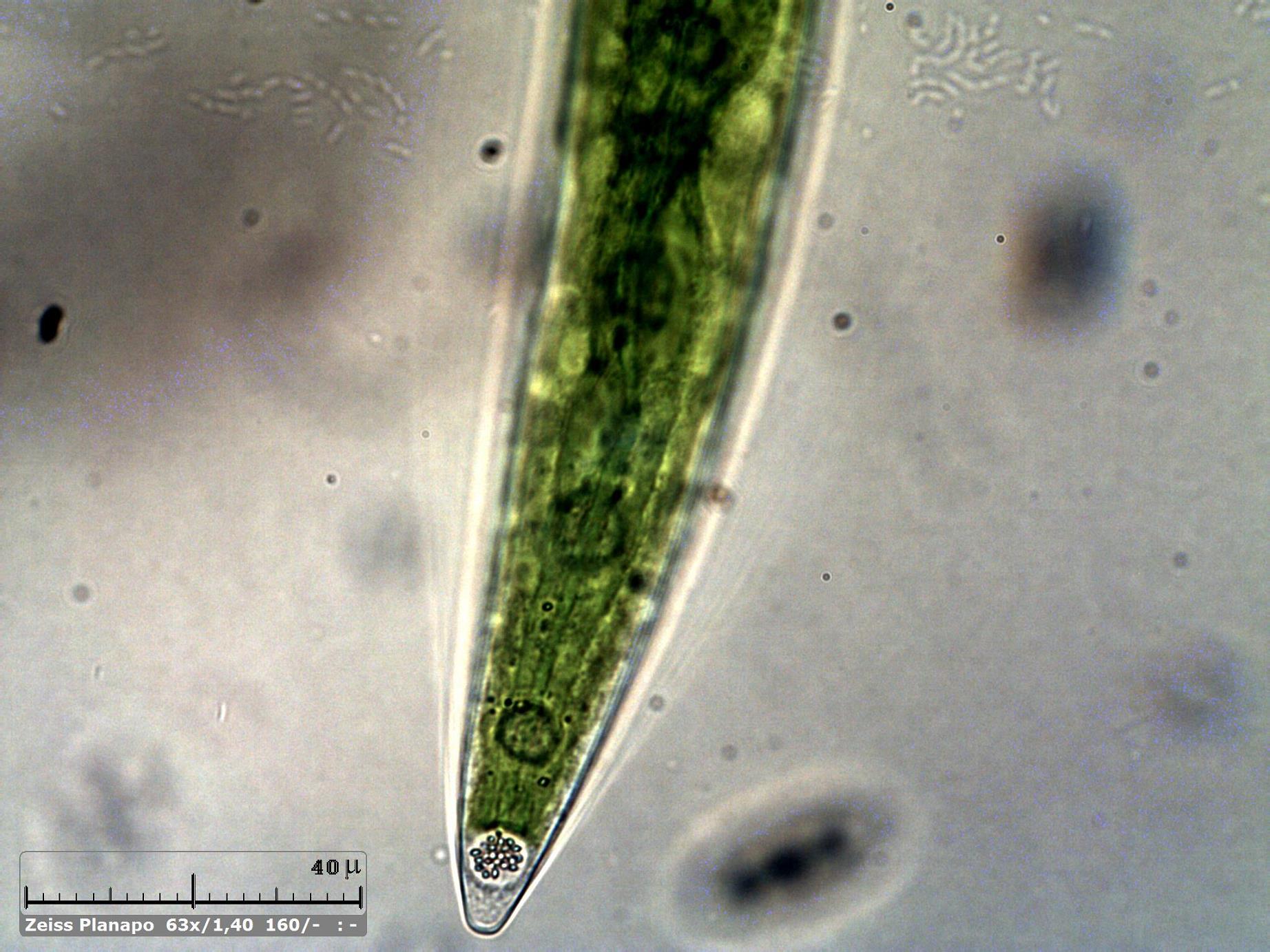 Closterium , Natura Mediterraneo | Forum Naturalistico