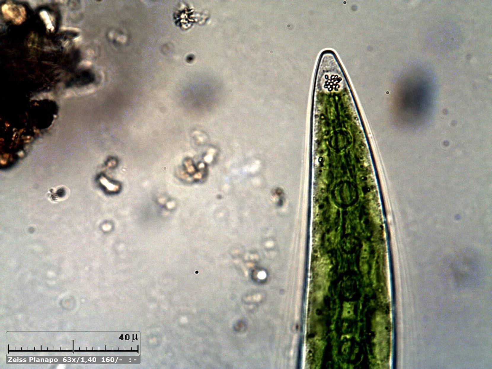 Closterium , Natura Mediterraneo | Forum Naturalistico