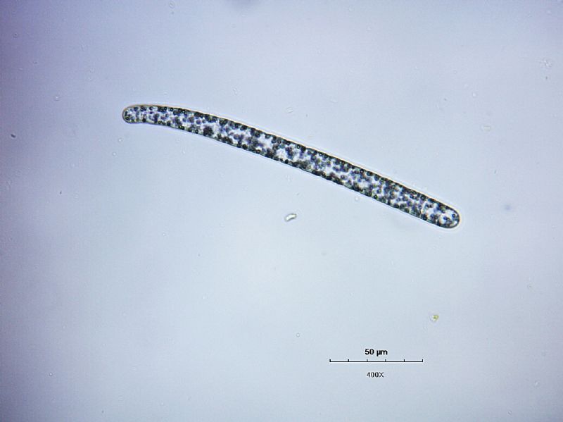 Beggiatoa sp. (solfobatterio) , Natura Mediterraneo | Forum Naturalistico