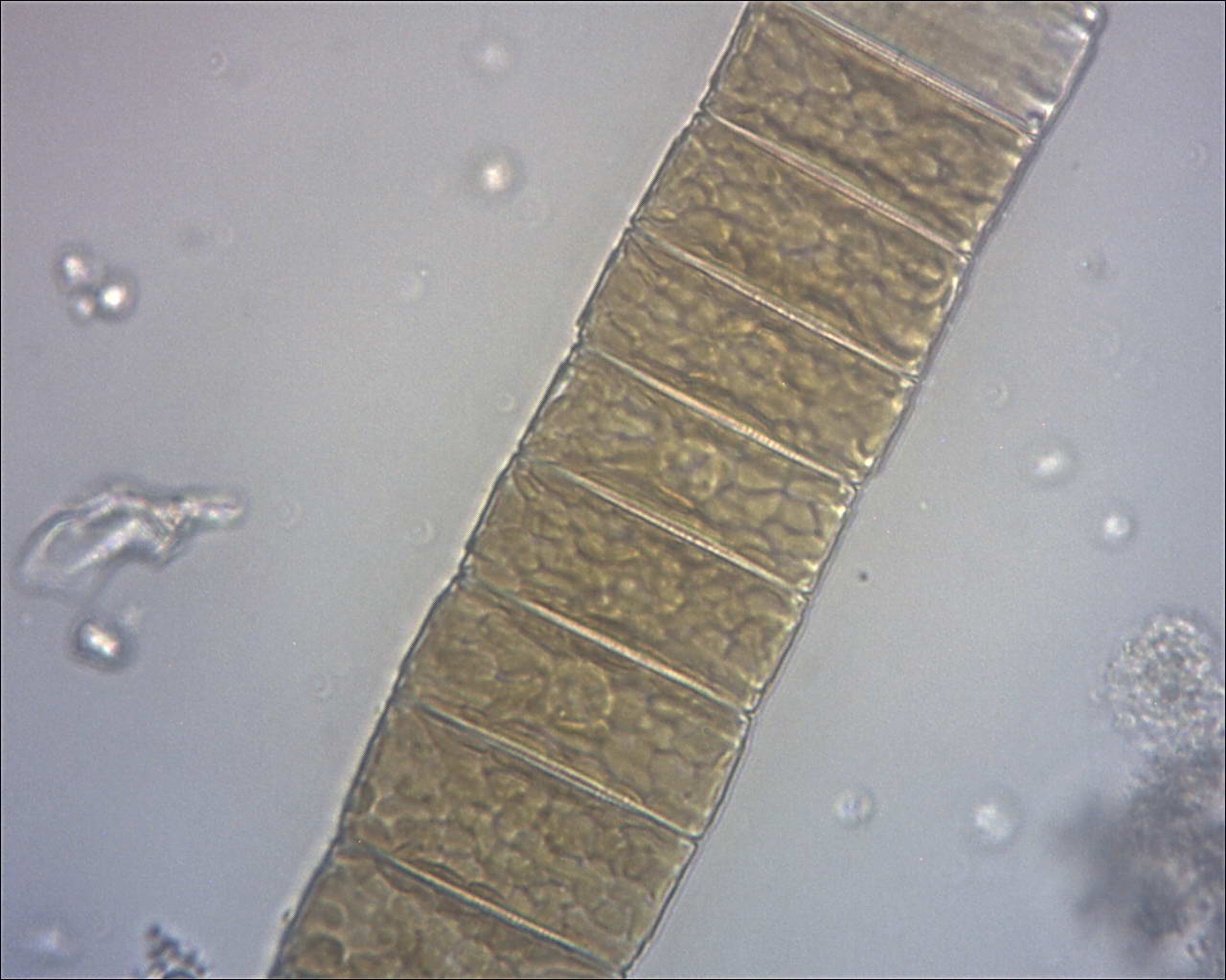 Microscopy forum - MicrobeHunter Microscopy Magazine | MicrobeHunter ...