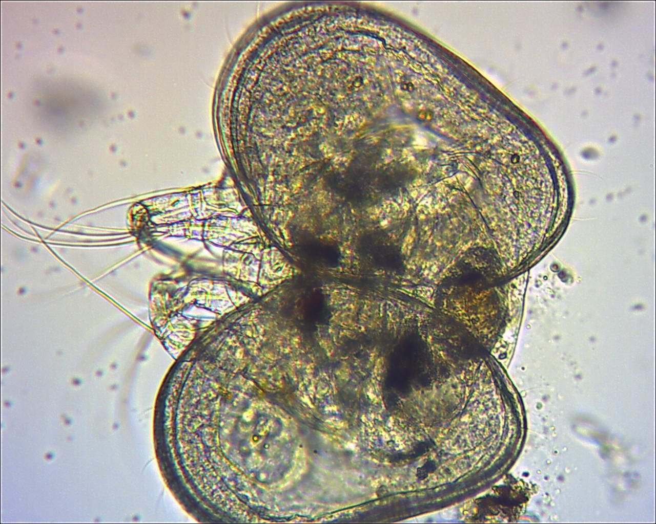 Microscopy forum - MicrobeHunter Microscopy Magazine | MicrobeHunter ...