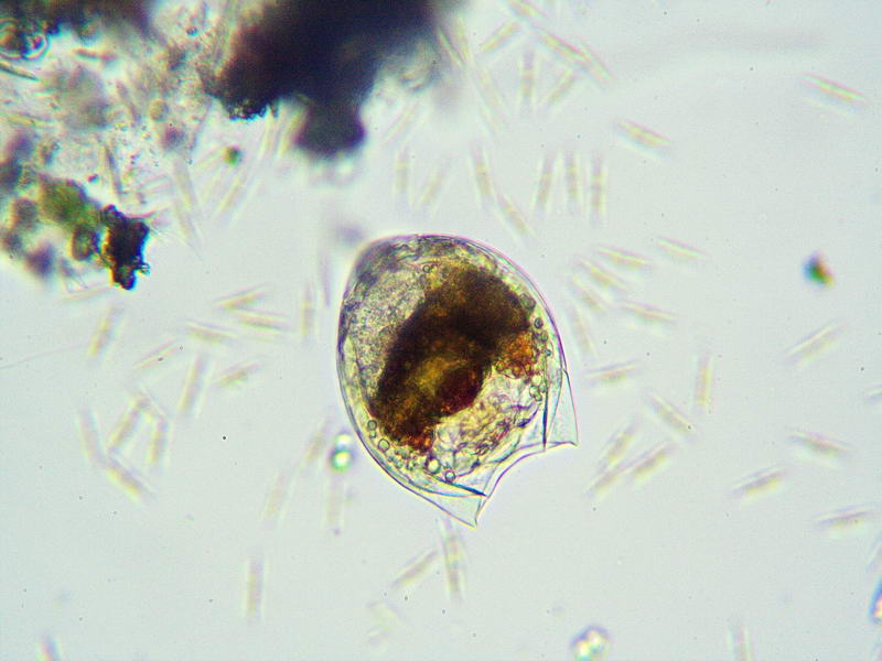 Lecane sp. , Natura Mediterraneo | Forum Naturalistico