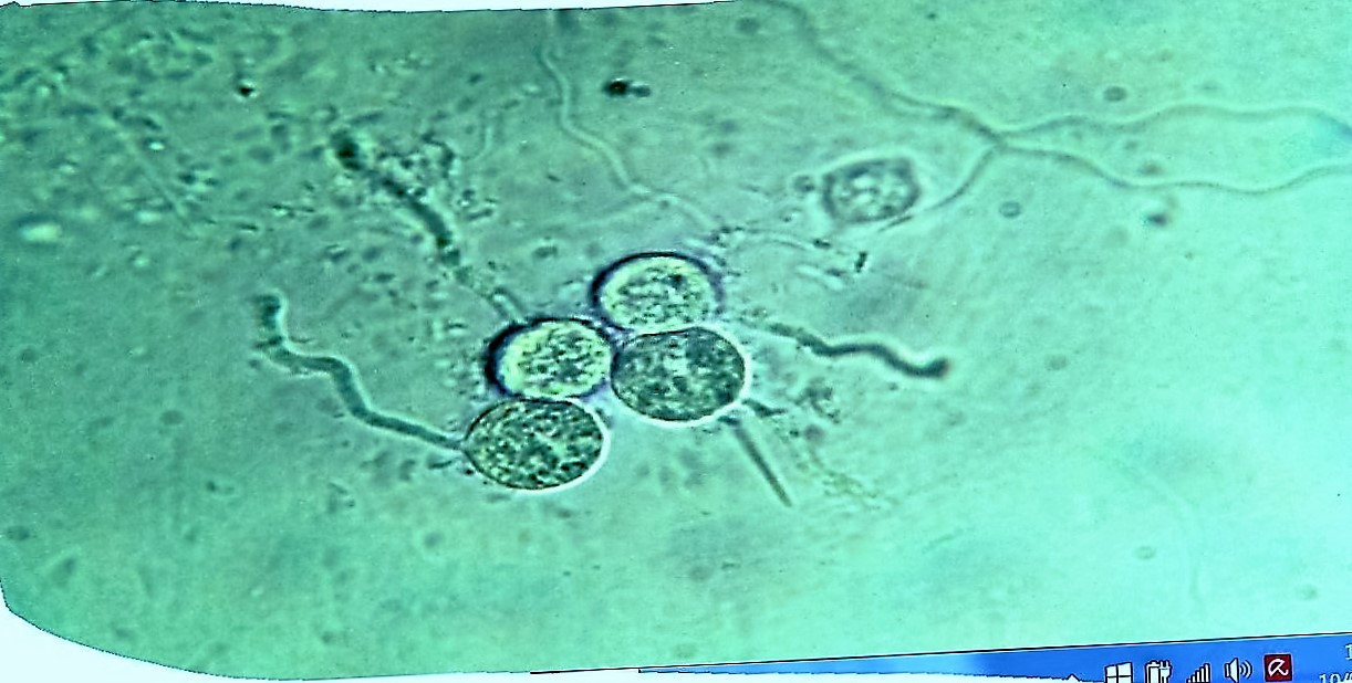 chromulina? , Natura Mediterraneo | Forum Naturalistico